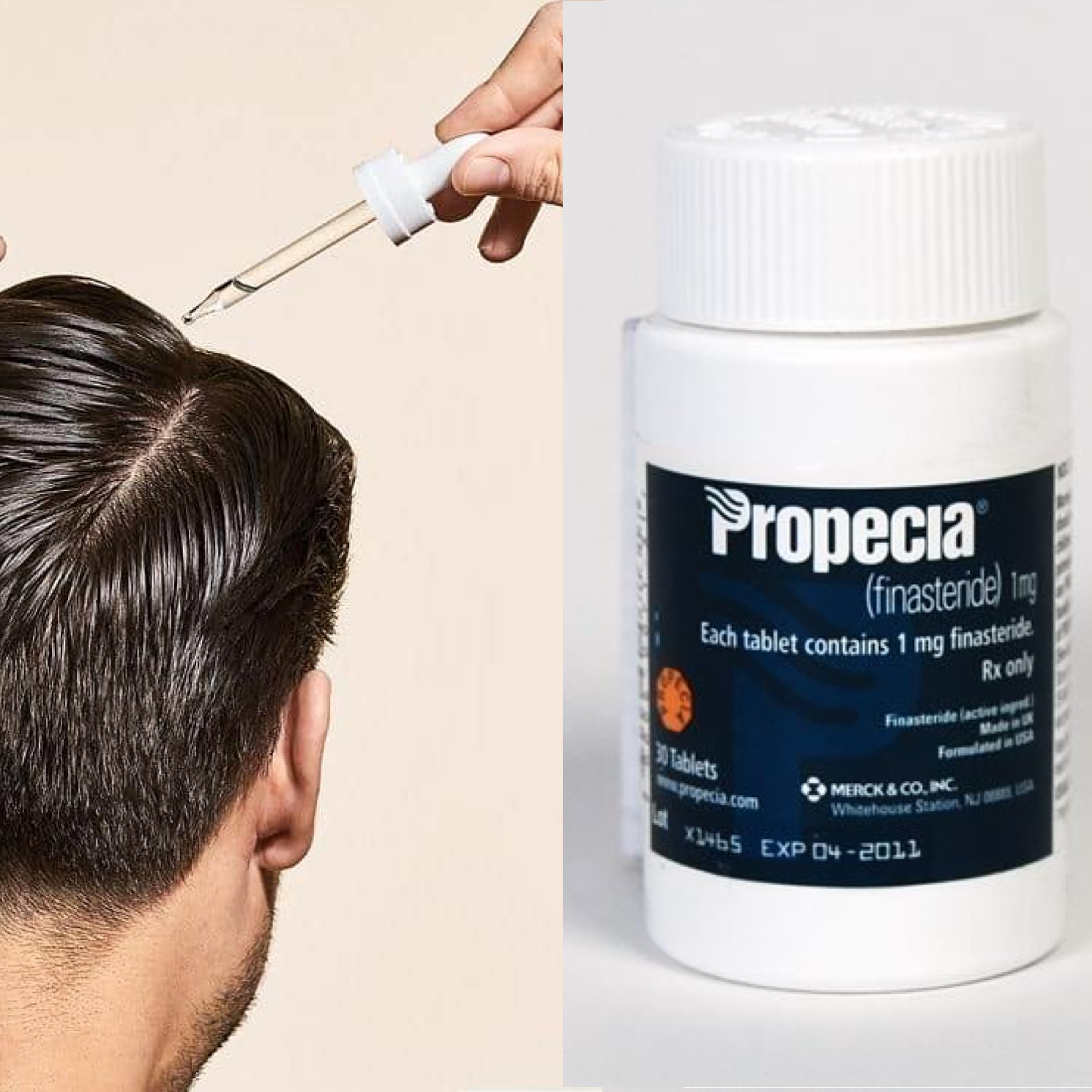 Oral and Topical Finasteride Efficacy for Hair Loss
